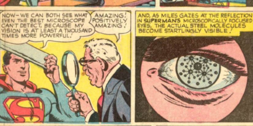 Superman: 10 Forgotten Silver Age Powers That Need To Come Back
