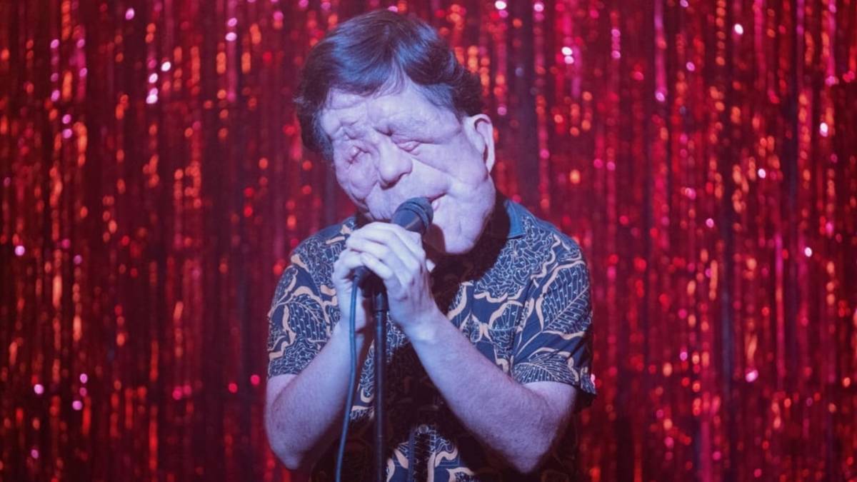 Adam Pearson Becomes First Disabled Person to Play The Elephant Man in ...